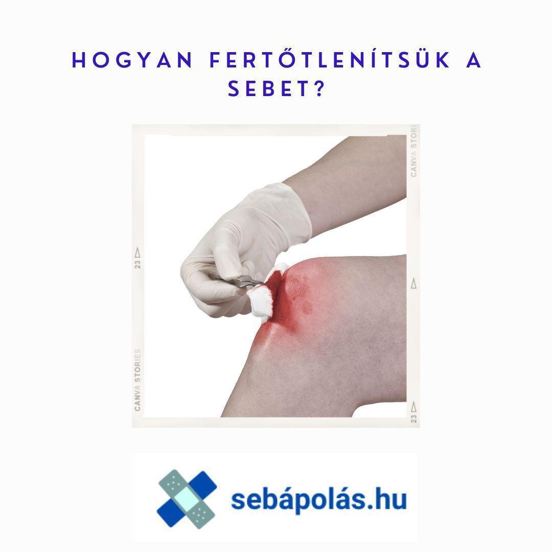 Hogyan fertőtlenítsük a sebet? - Sebápolás